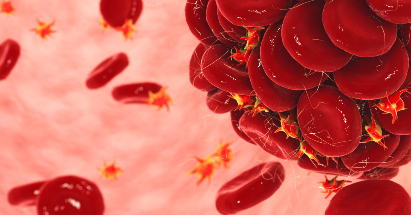 Thrombosen bei PNH | leben-mit-blutkrankheiten.de
