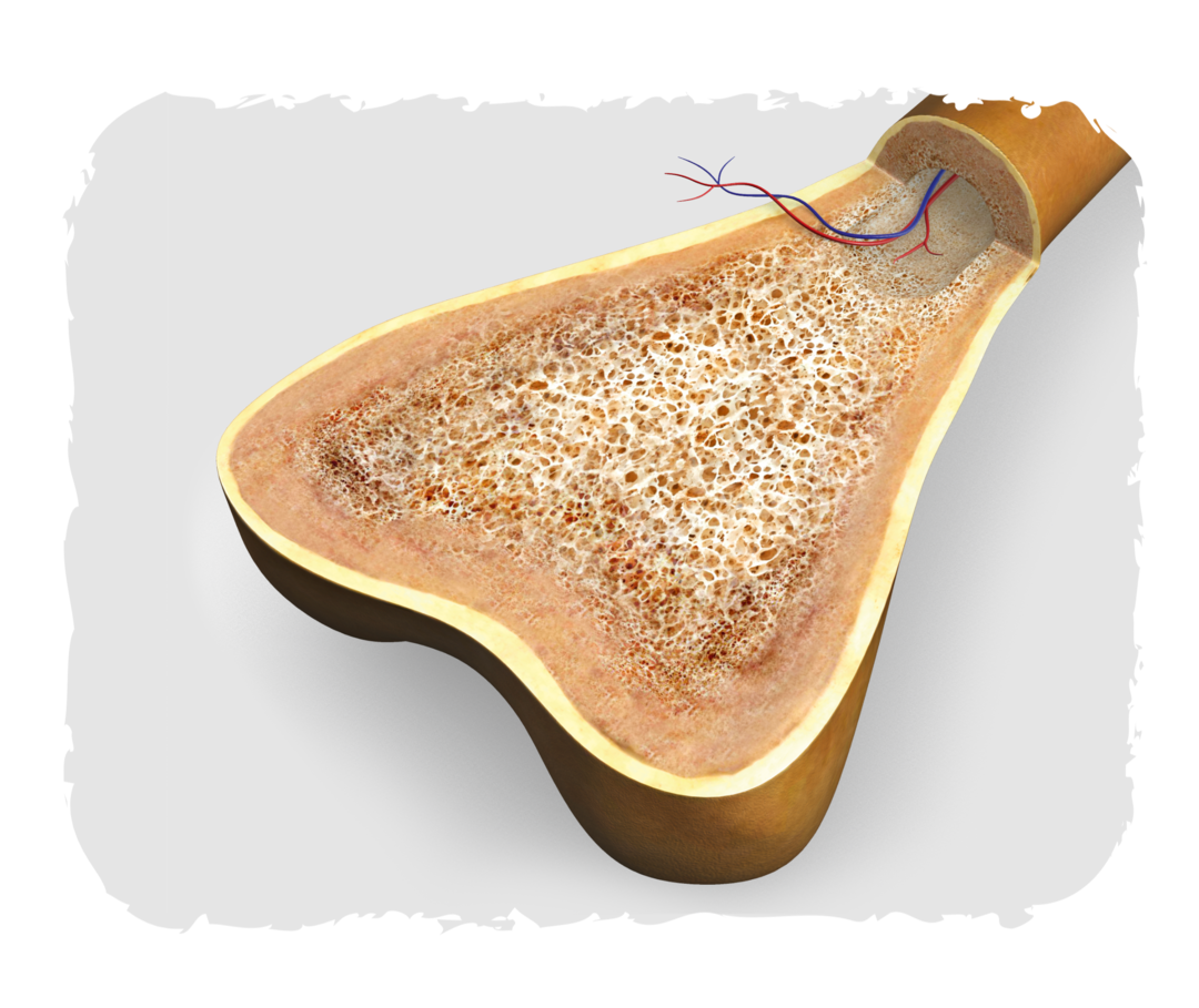 Myelofibrose: Symptome | leben-mit-blutkrankheiten.de